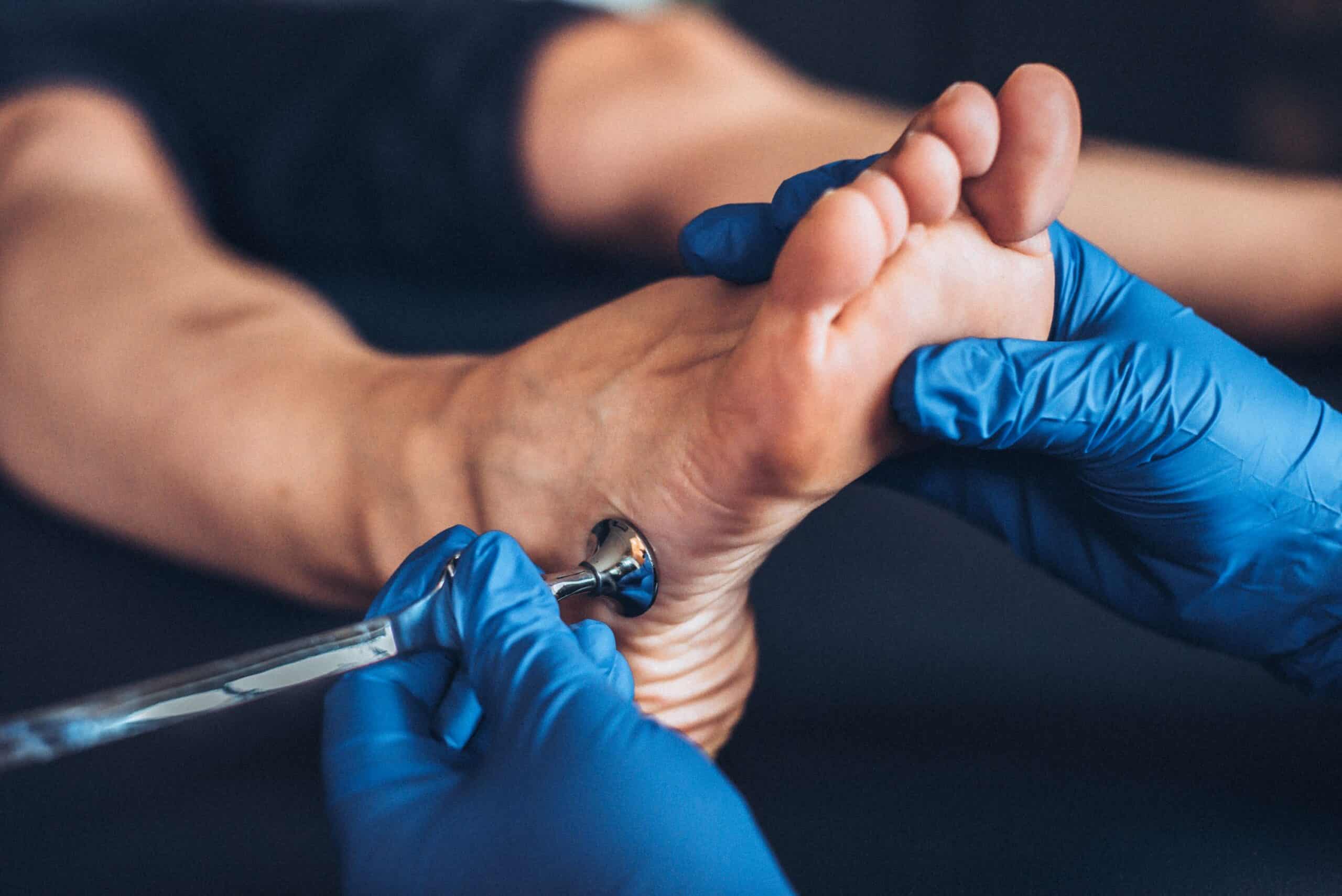 How to take care of your feet if you have diabetes? - Walk This Way ...